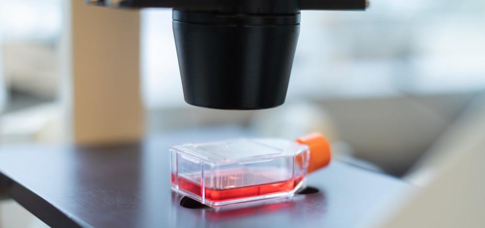 Case Study: Enabling tissue engineering through robust process ... Case Study: Enabling tissue engineering through robust process ...
